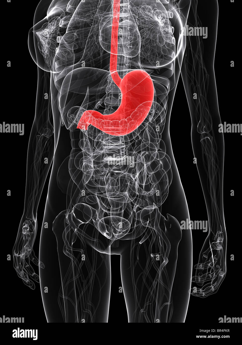 Stomach metastasis hi-res stock photography and images - Alamy