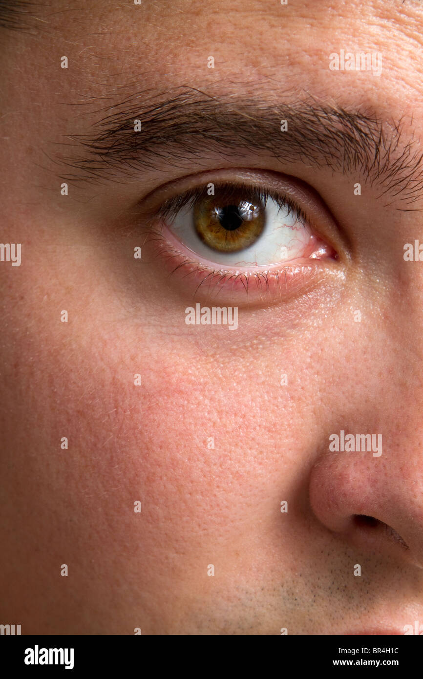 Bloodshot eyeball hi-res stock photography and images - Alamy