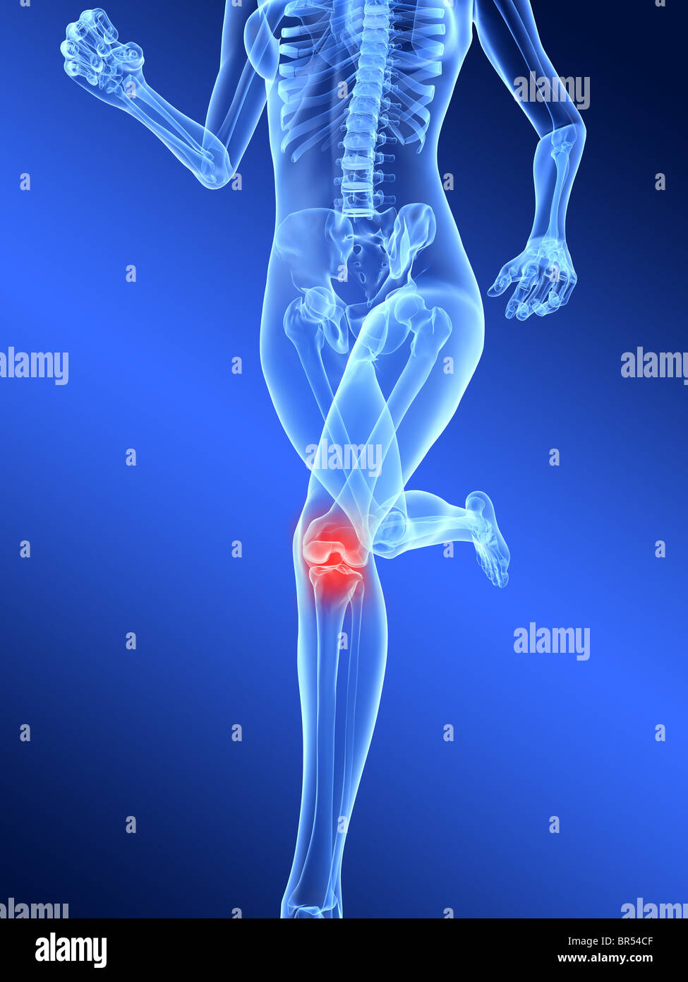 painful knee illustration Stock Photo - Alamy