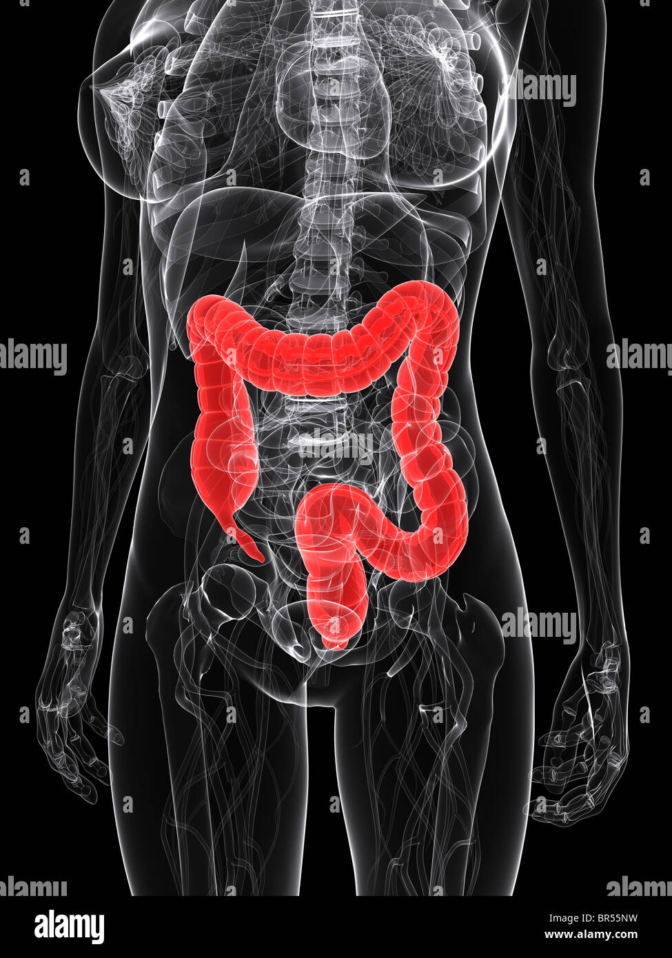 Colon cancer x ray hi-res stock photography and images - Alamy
