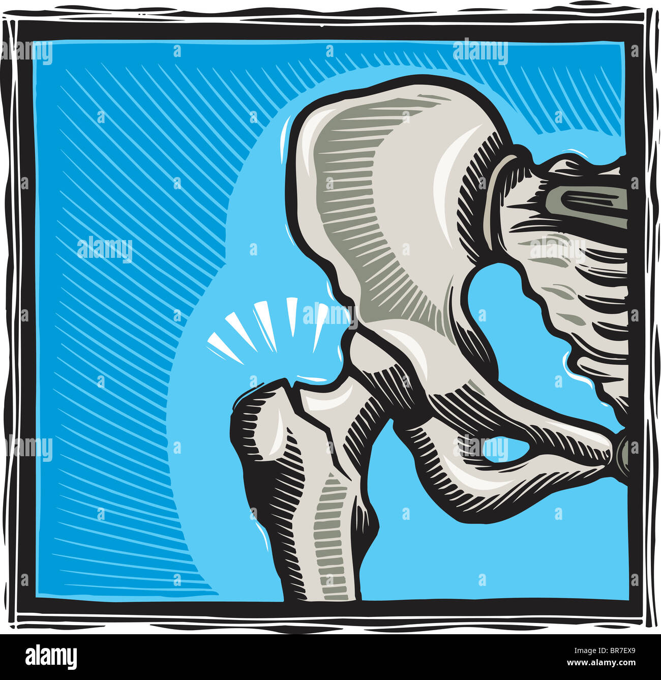 a broken hip bone Stock Photo - Alamy