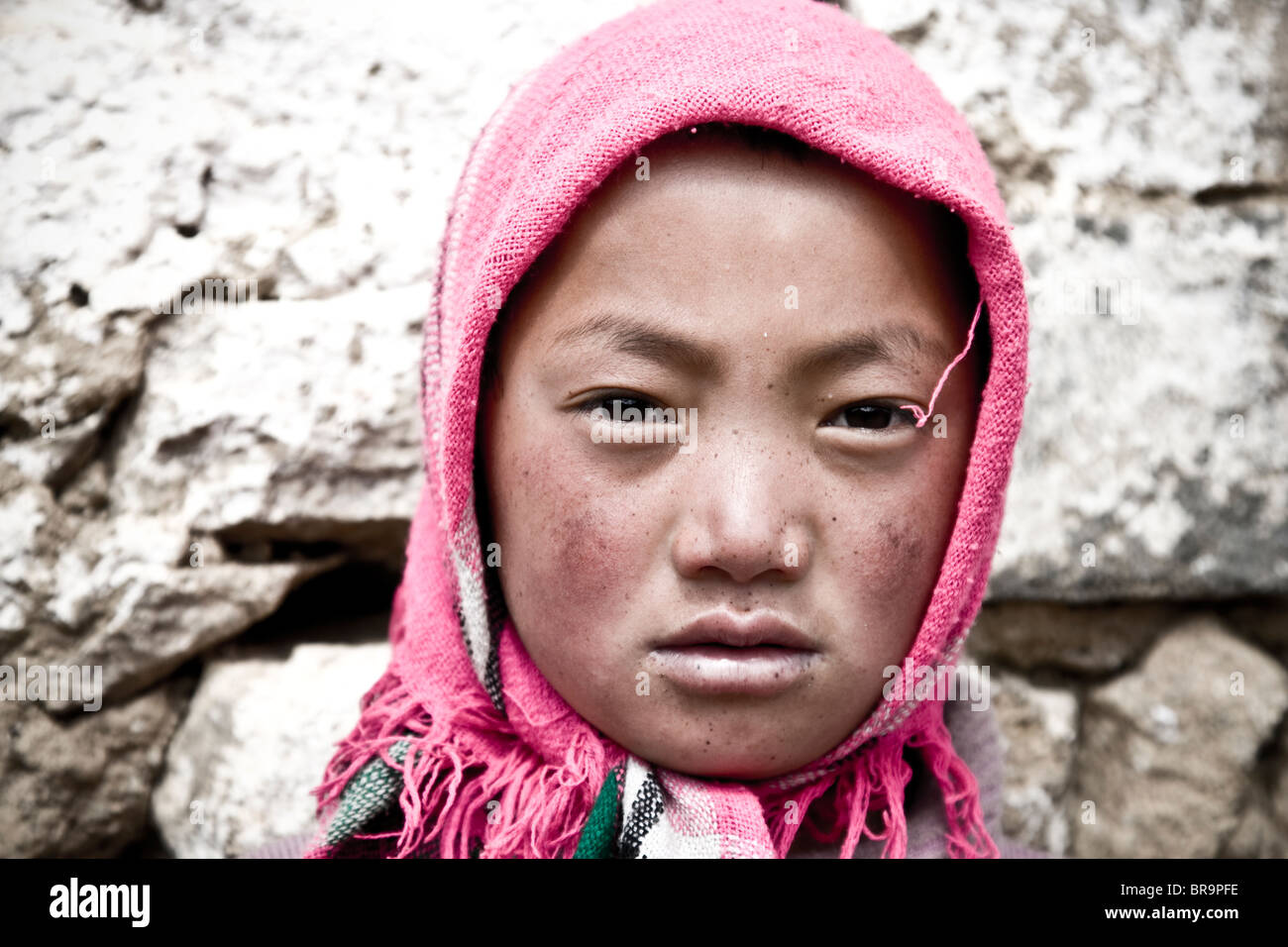A young school girl with wind burnt cheeks and a pink wrap covering her ...