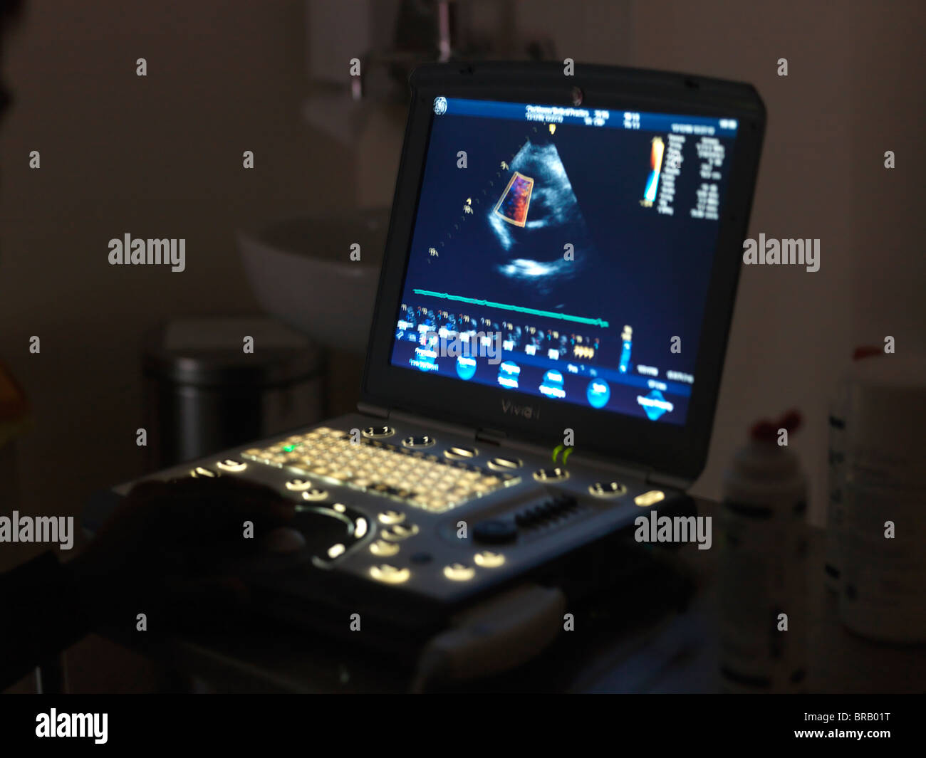 Heart Scan On Laptop In Private Clinic England Stock Photo - Alamy