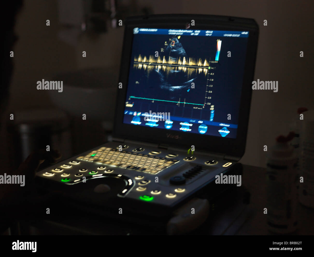 Heart Scan On Laptop In Private Clinic England Stock Photo - Alamy