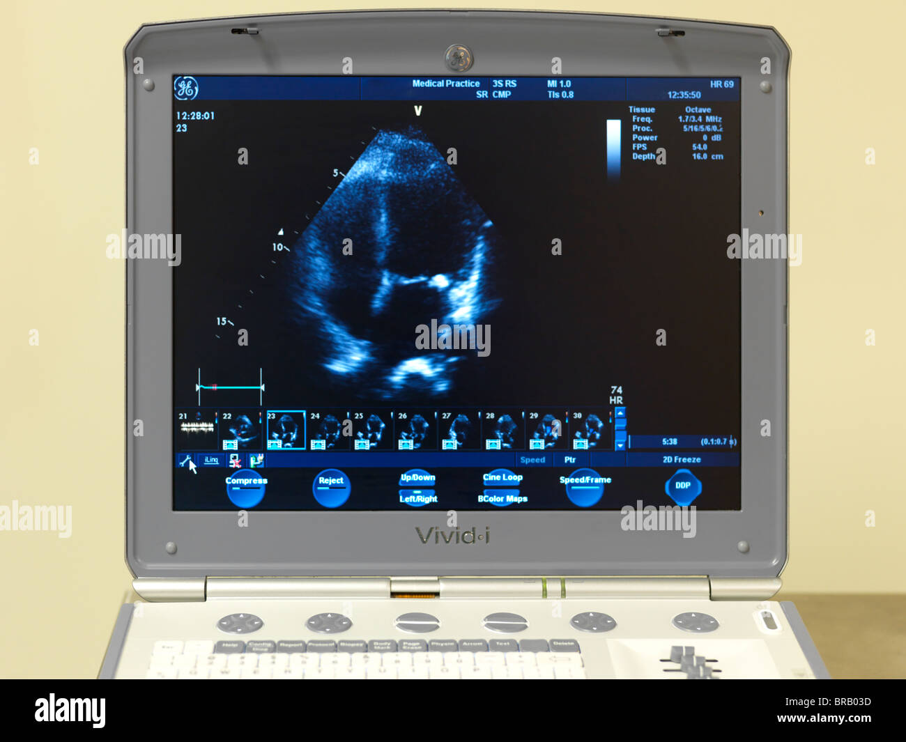 Heart Scan On Laptop In Private Clinic England Stock Photo - Alamy