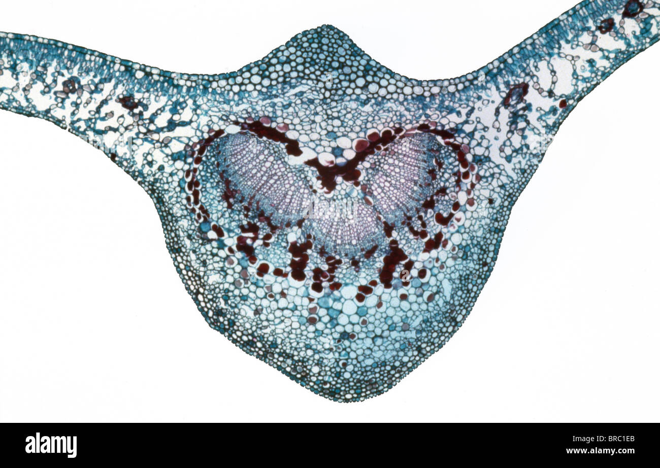 Light Micrograph (LM) of a transverse section of a leaf of a Cherry ...