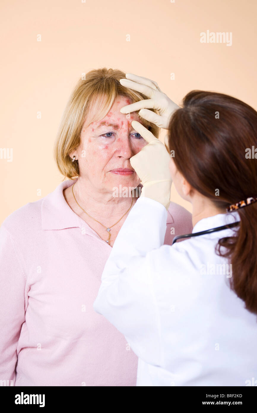 Face skin rash hi-res stock photography and images - Alamy