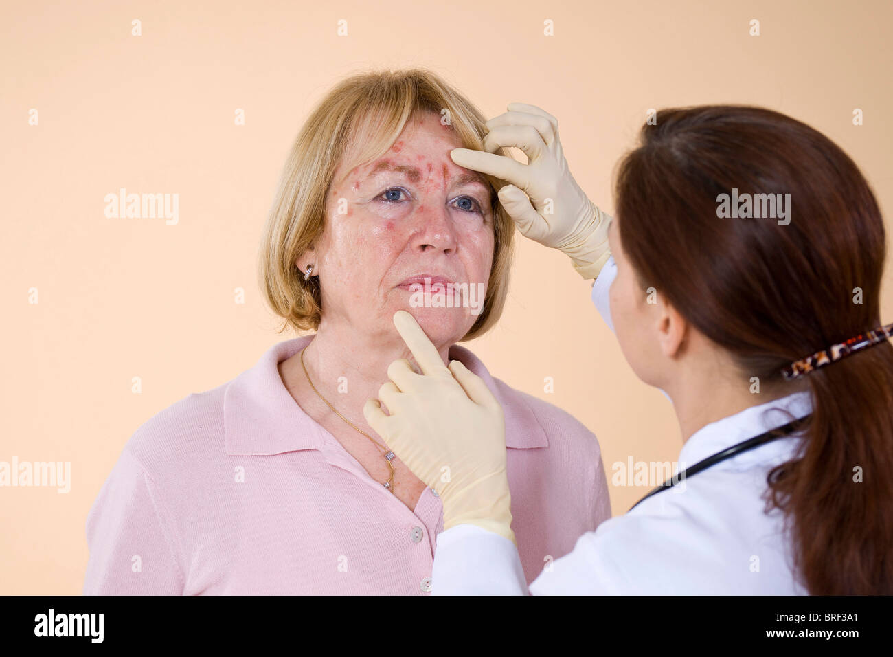Doctor examining the facial skin rash of a patient Stock Photo - Alamy