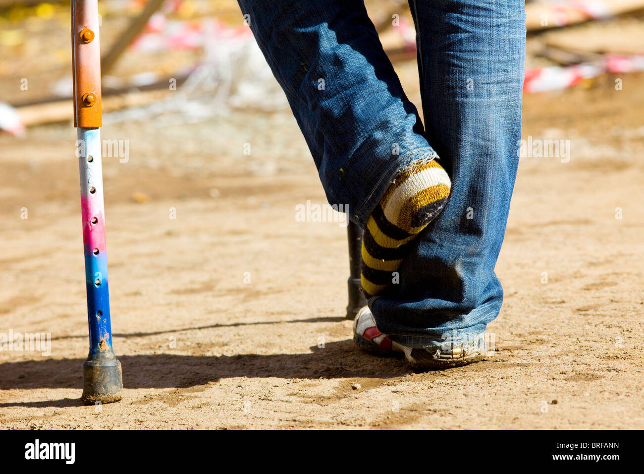 color crutch and broken leg in striped sock Stock Photo - Alamy