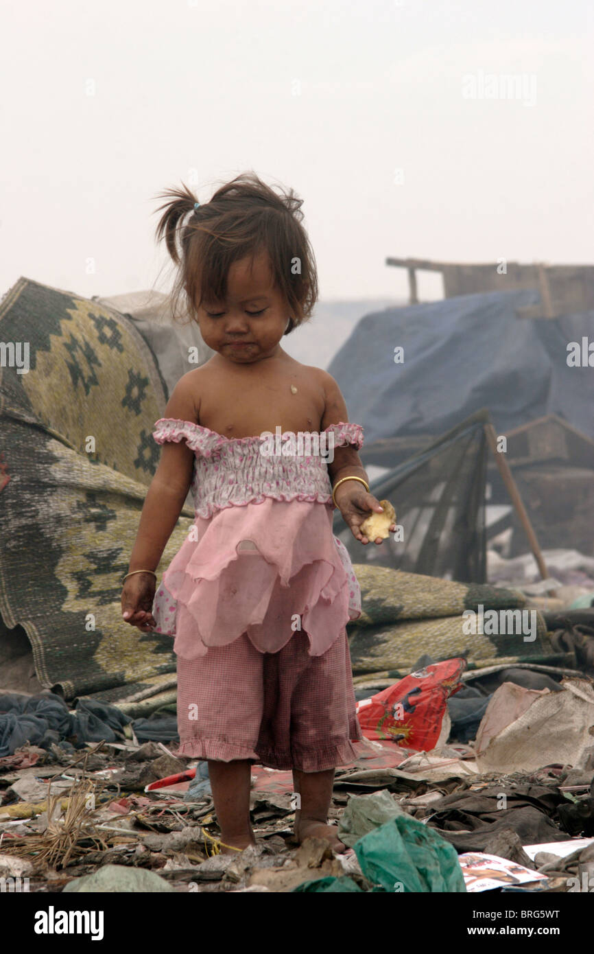 A Young Girl Displays The Effects Of Living In A Garbage Dump At The Stung Meanchey Landfill In