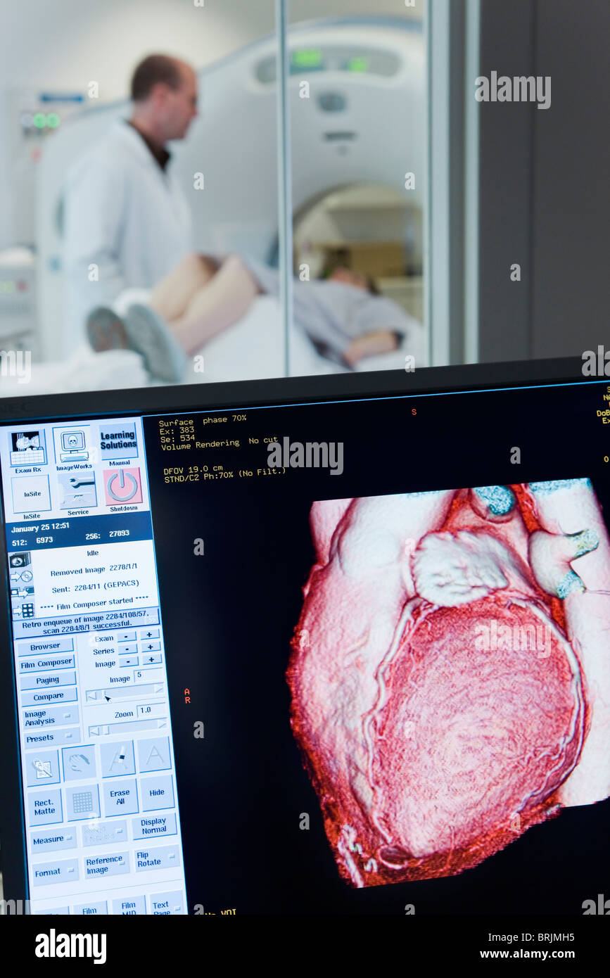 Heart CAT scan result shown on monitor Stock Photo - Alamy