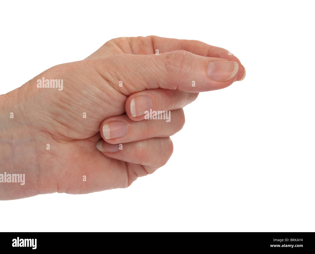 Hand pinch skin hi-res stock photography and images - Alamy