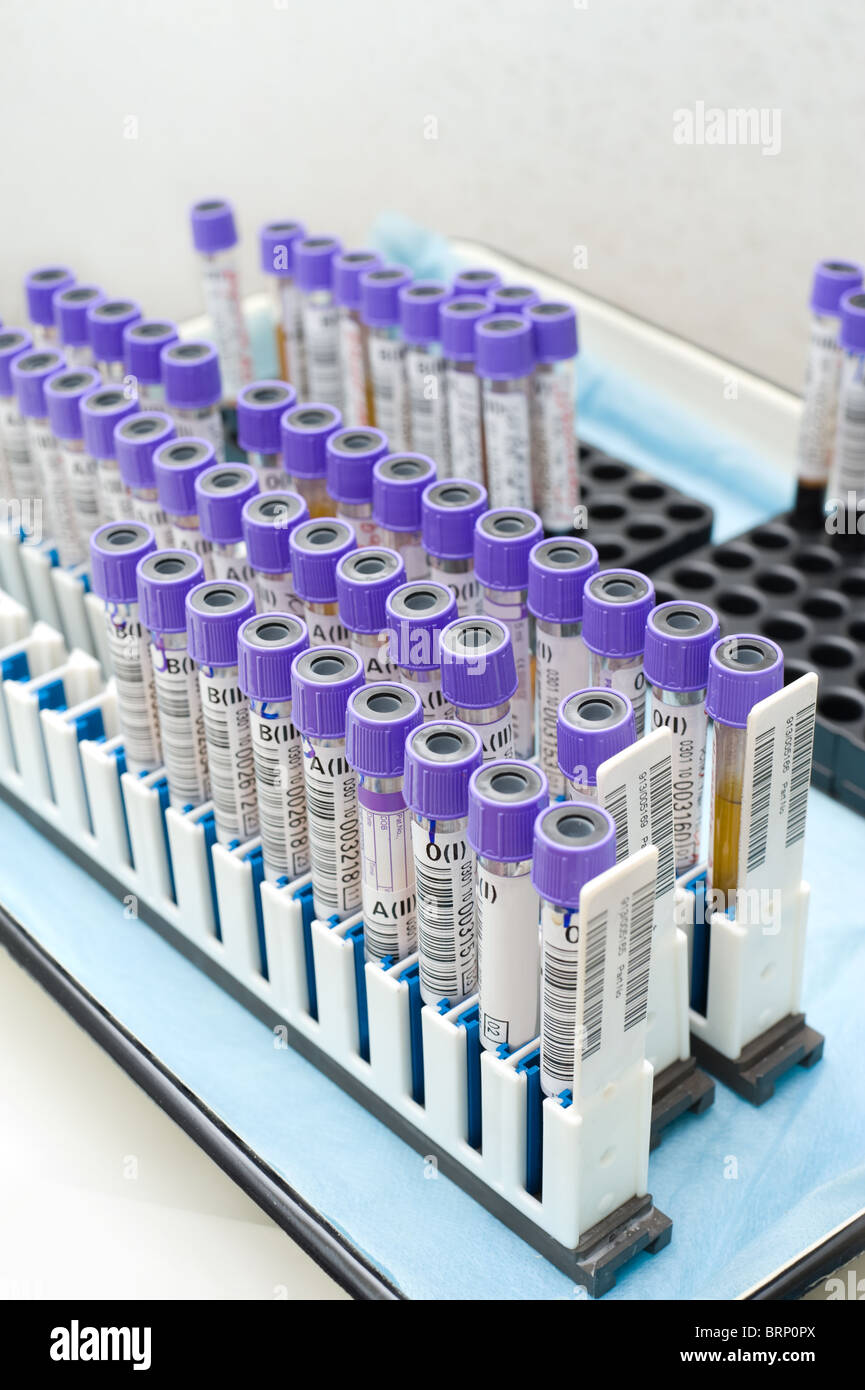 many test tubes with donor blood being tested Stock Photo - Alamy