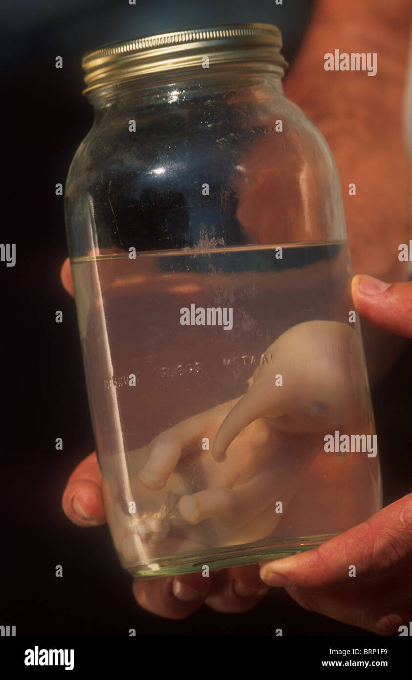 Elephant embryo Preserved in Bottle - one of the display items in the ...