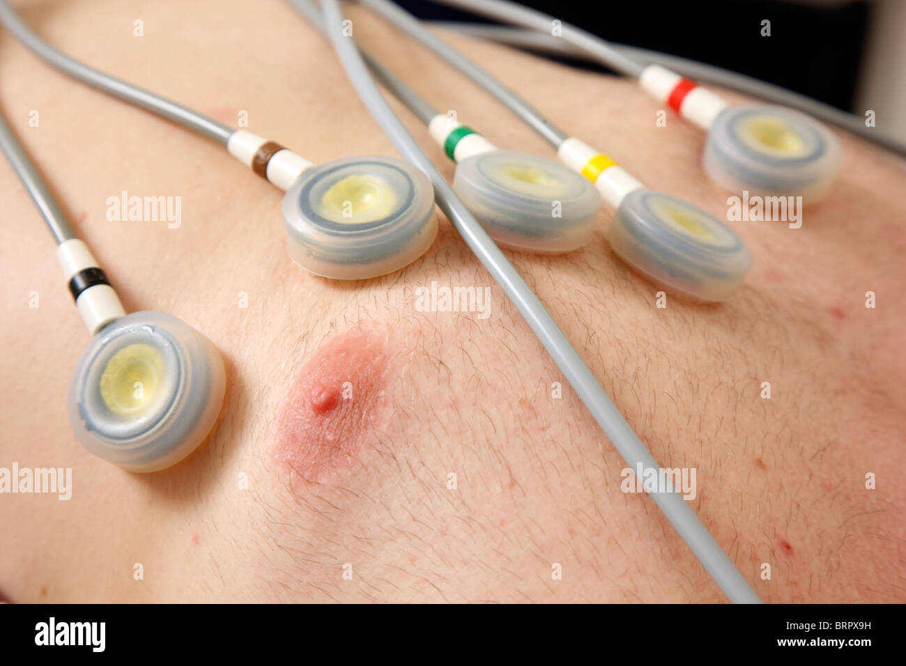 Doctor's surgery, patient at an ECG, Electro cardiograph, test ...