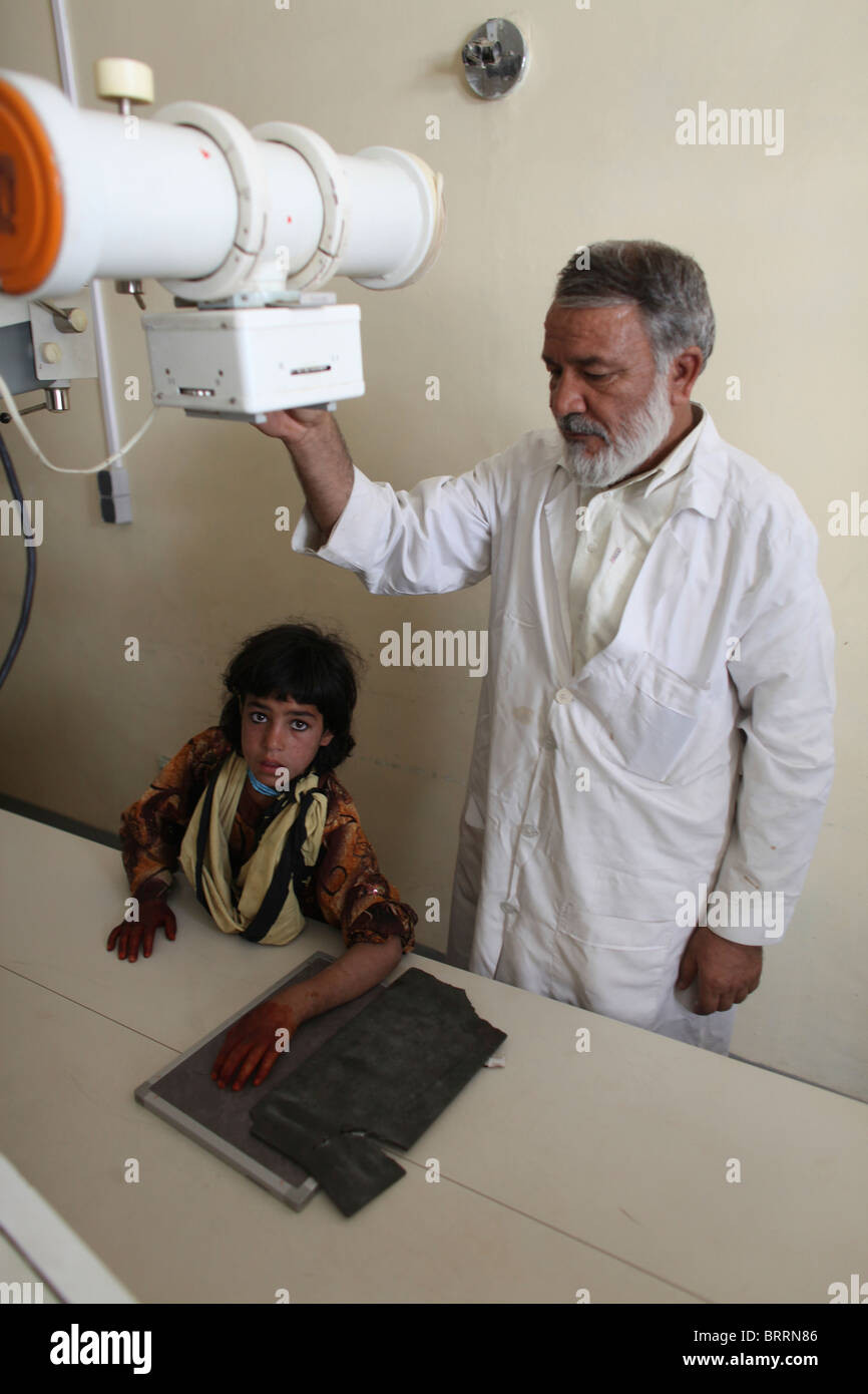 x-rays of wounded civilians in Afghanistan Stock Photo - Alamy