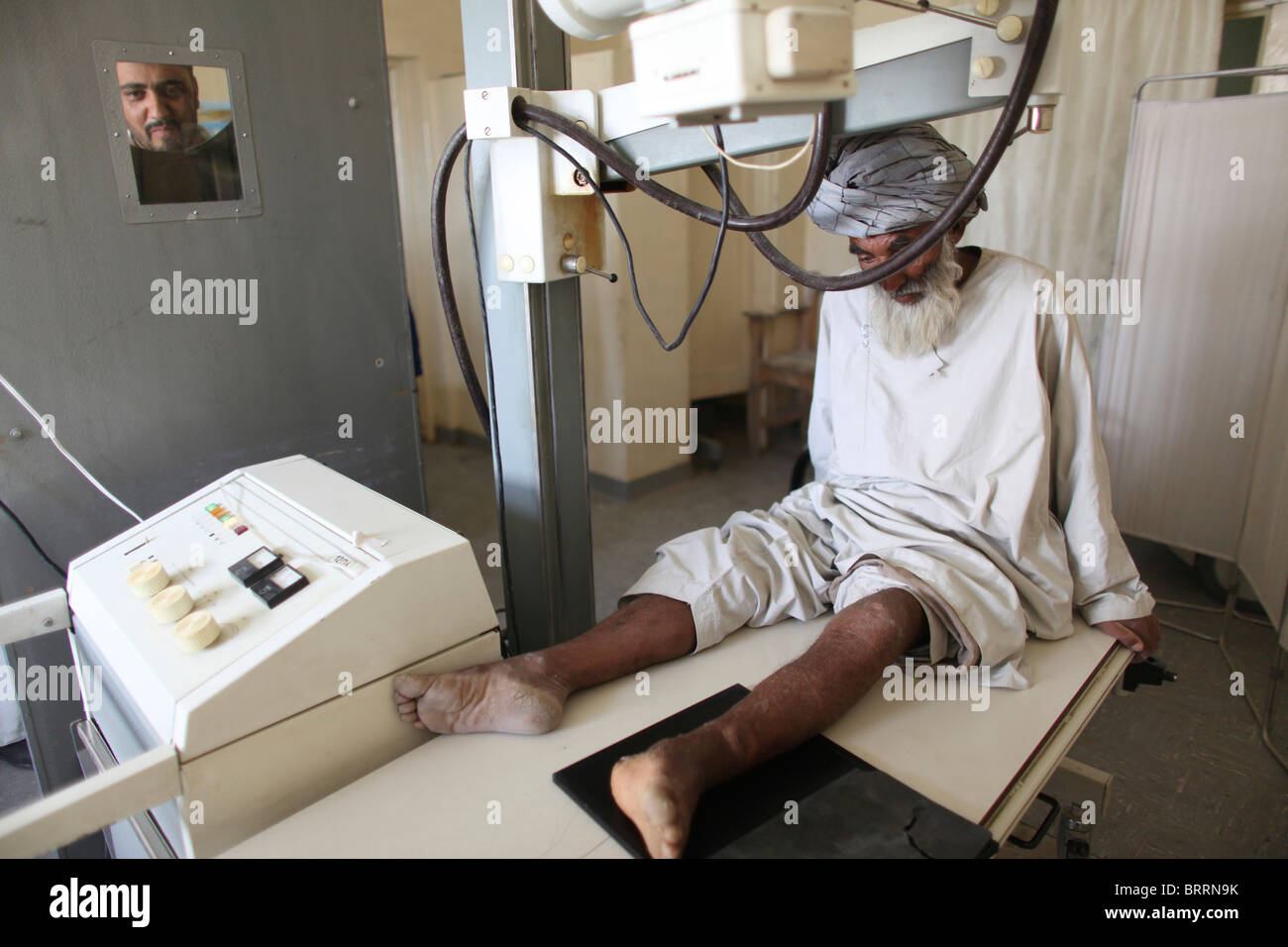 x-rays of wounded civilians in Afghanistan Stock Photo - Alamy