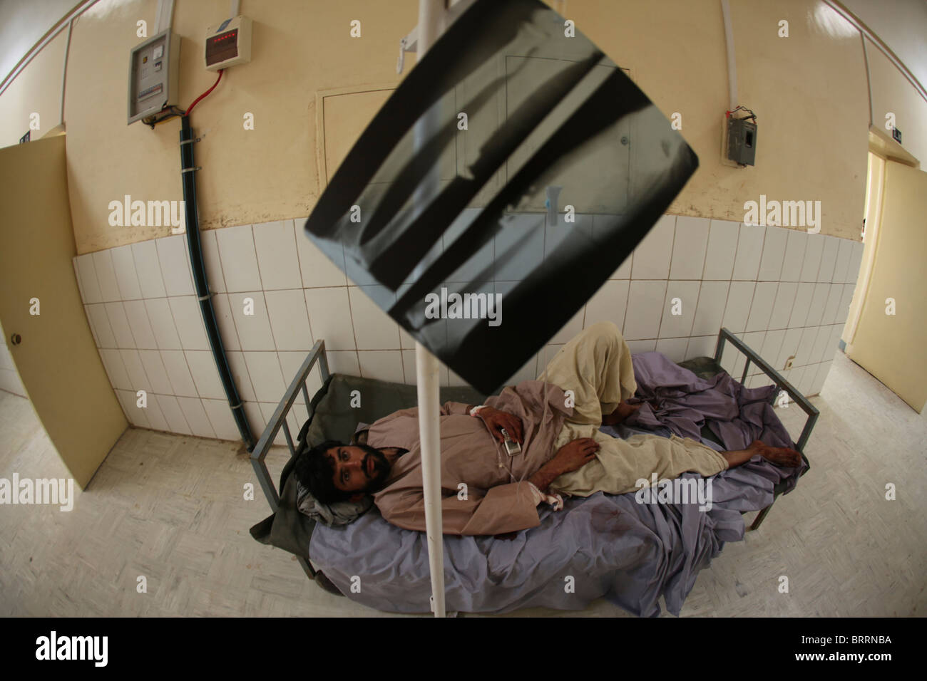 x-rays of wounded civilians in Afghanistan Stock Photo - Alamy