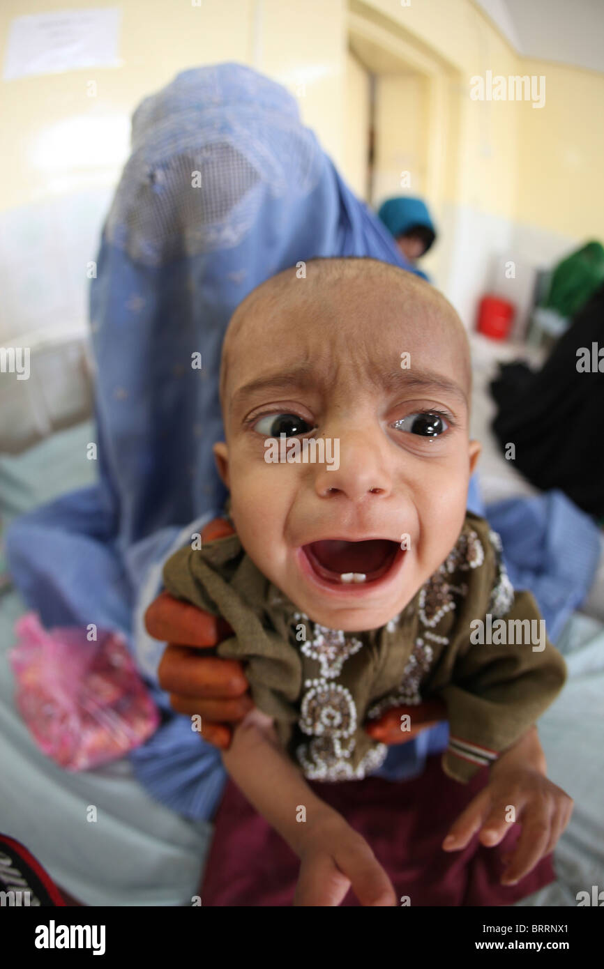 pediatric ward of an Afghan hospital Stock Photo - Alamy