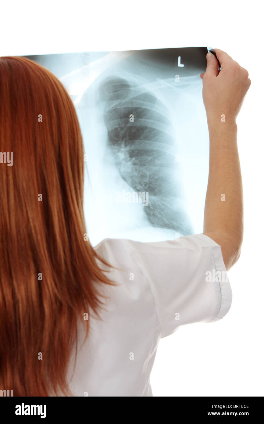 Female doctor examining a chest x-ray photo scan. Isolated on white ...