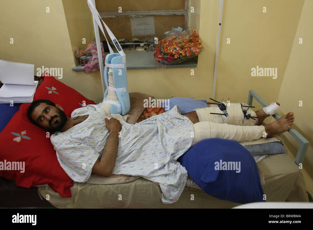 victims of a IED attack in Afghanistan Stock Photo - Alamy