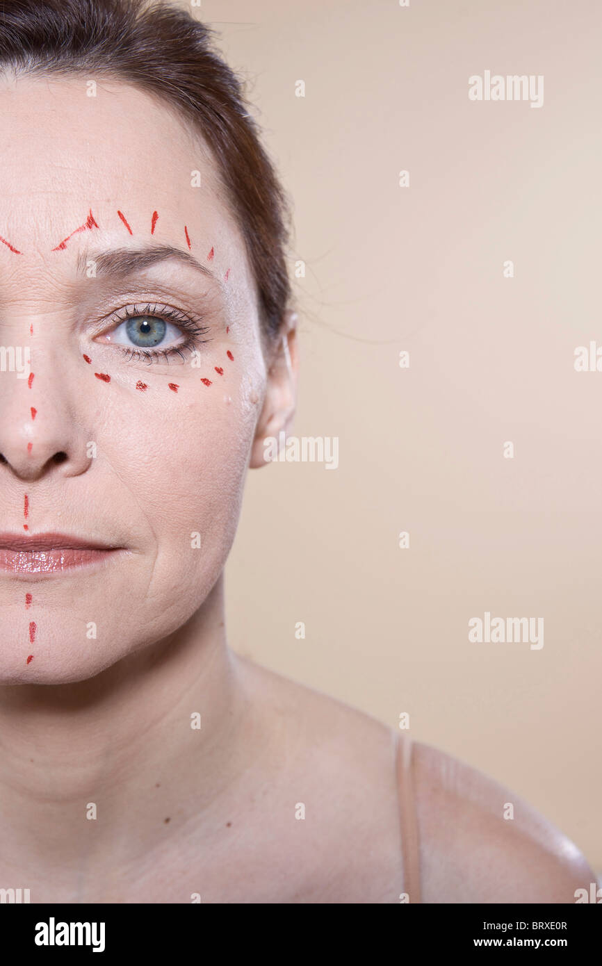 Woman's face with marks for a cosmetic surgery Stock Photo - Alamy