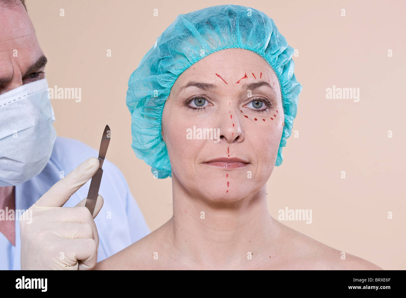 Portrait of a woman with lines on her face for a cosmetic surgery Stock ...
