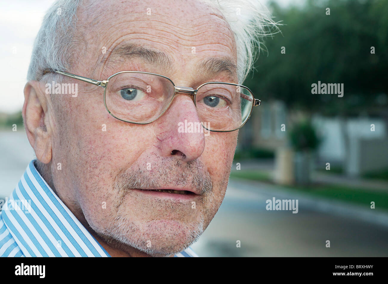 Old age spots hi-res stock photography and images - Alamy