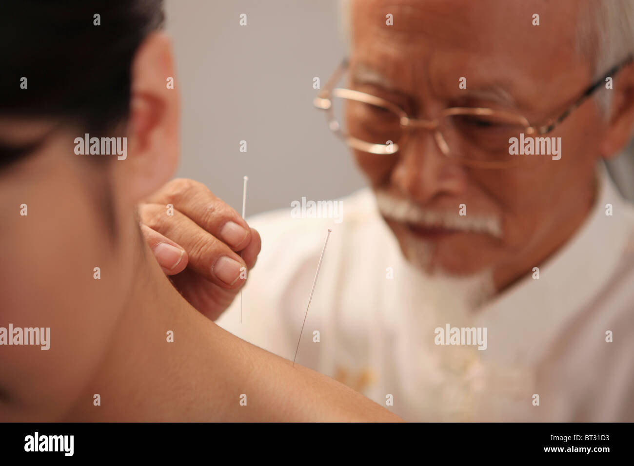 Doctor holding acupuncture needles hi-res stock photography and images ...
