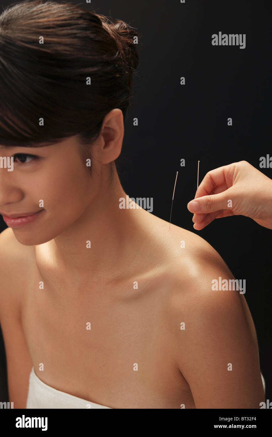 Doctor putting acupuncture needles on womans back hi-res stock ...