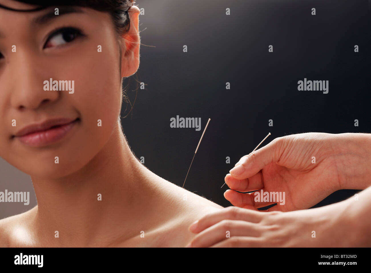 Doctor putting acupuncture needles on womans shoulder hi-res stock ...