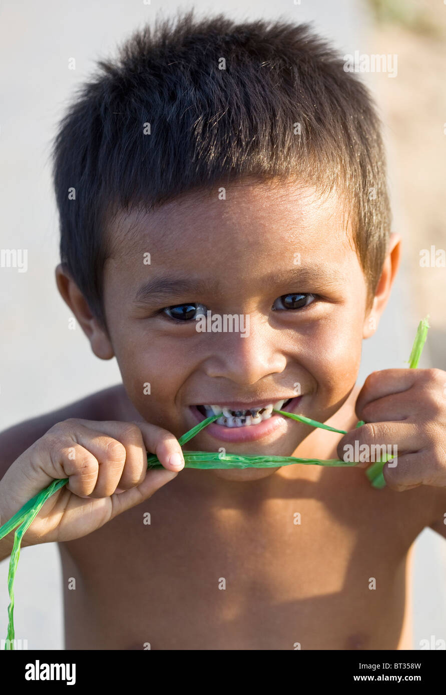 Young Boy with Rotten front Teeth Phnom Penh Cambodia Stock Photo - Alamy