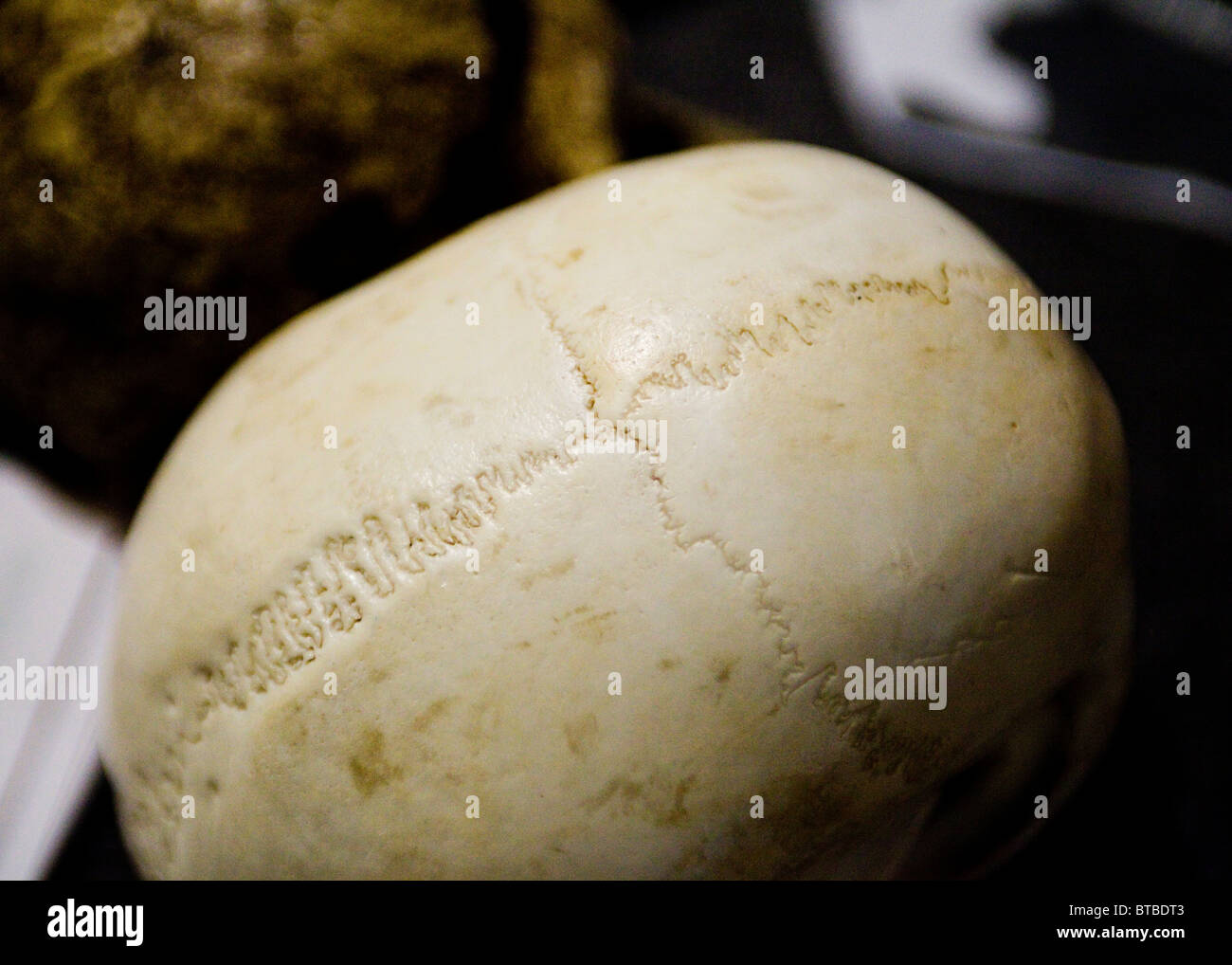 Skull sutures hi-res stock photography and images - Alamy