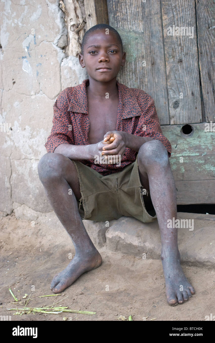 Zambia poverty hi-res stock photography and images - Alamy