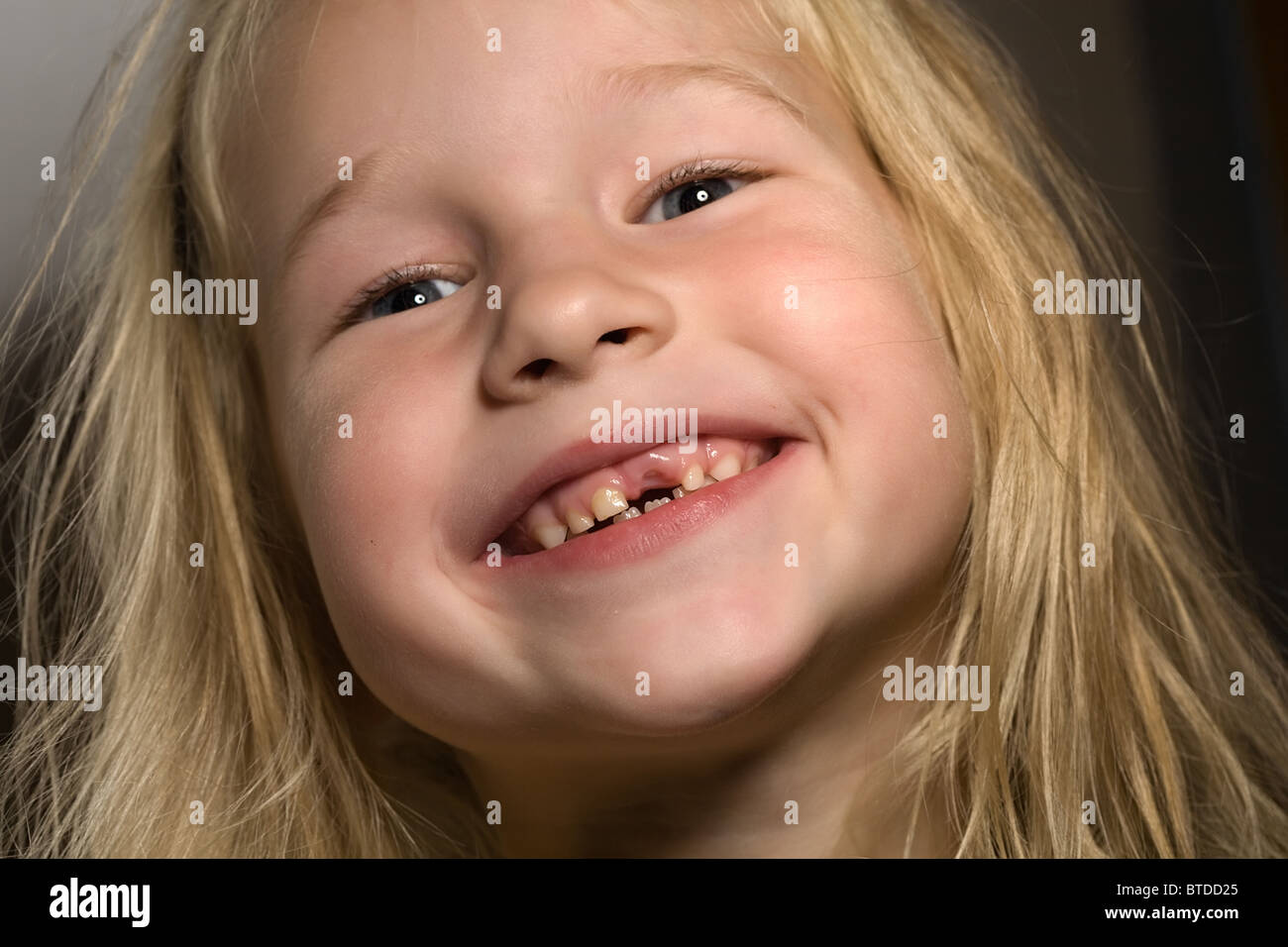 closeup portrait of funny smiling little girl without one front tooth ...