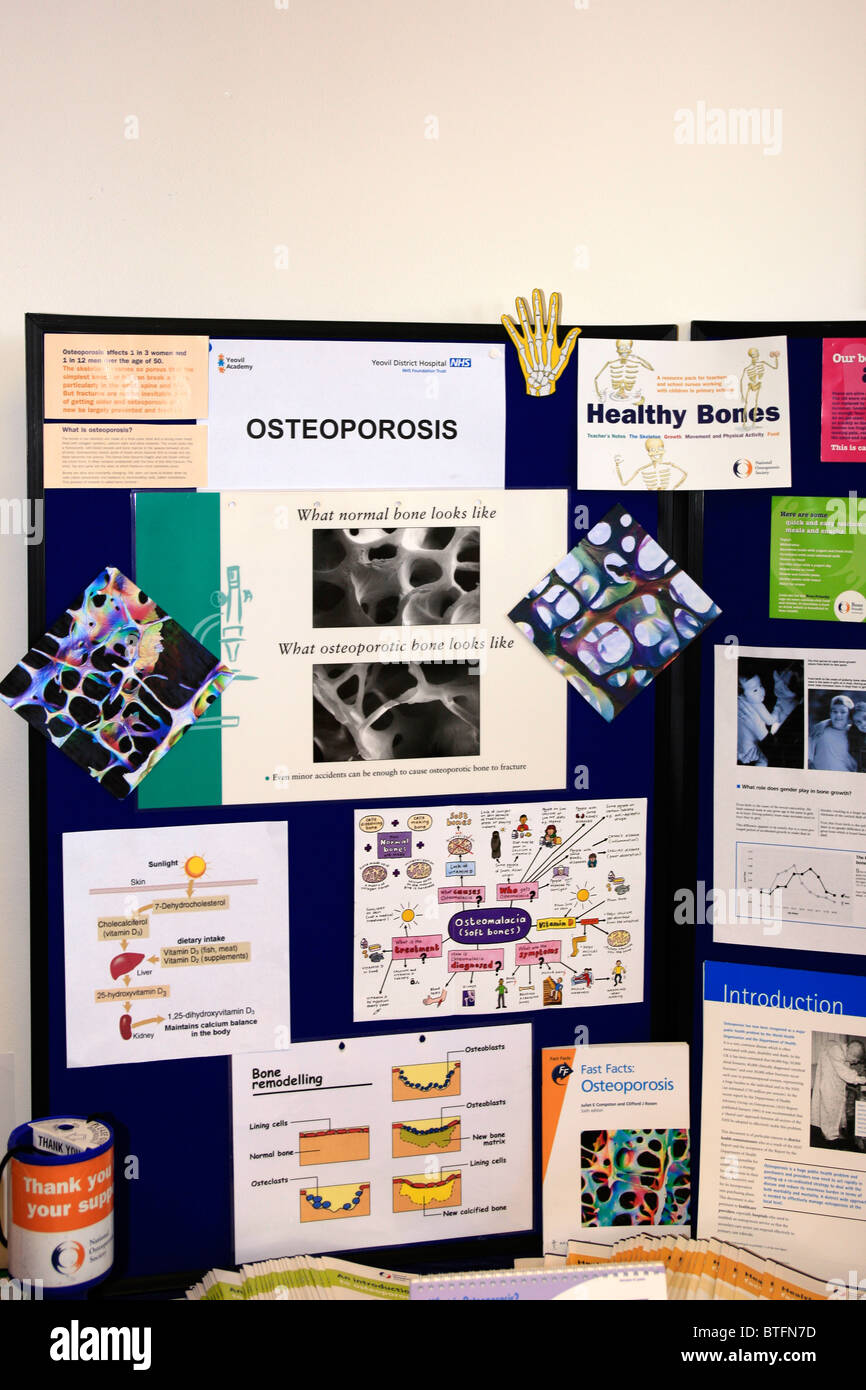 Osteoporosis awareness wall posters at a NHS hospital open day Stock ...