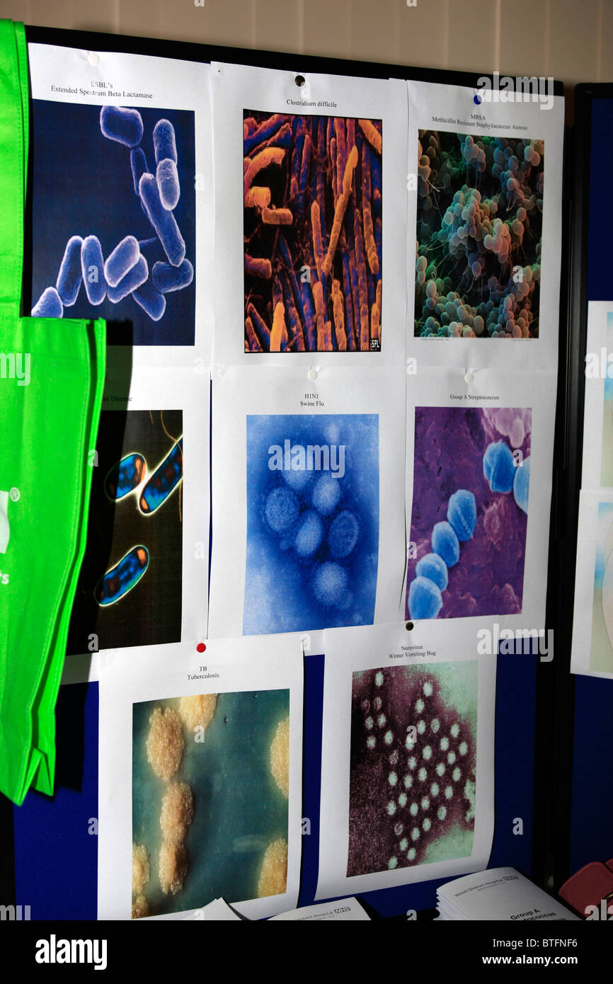 Photos of hospital bugs such as MRSA enlarged for public viewing at a ...