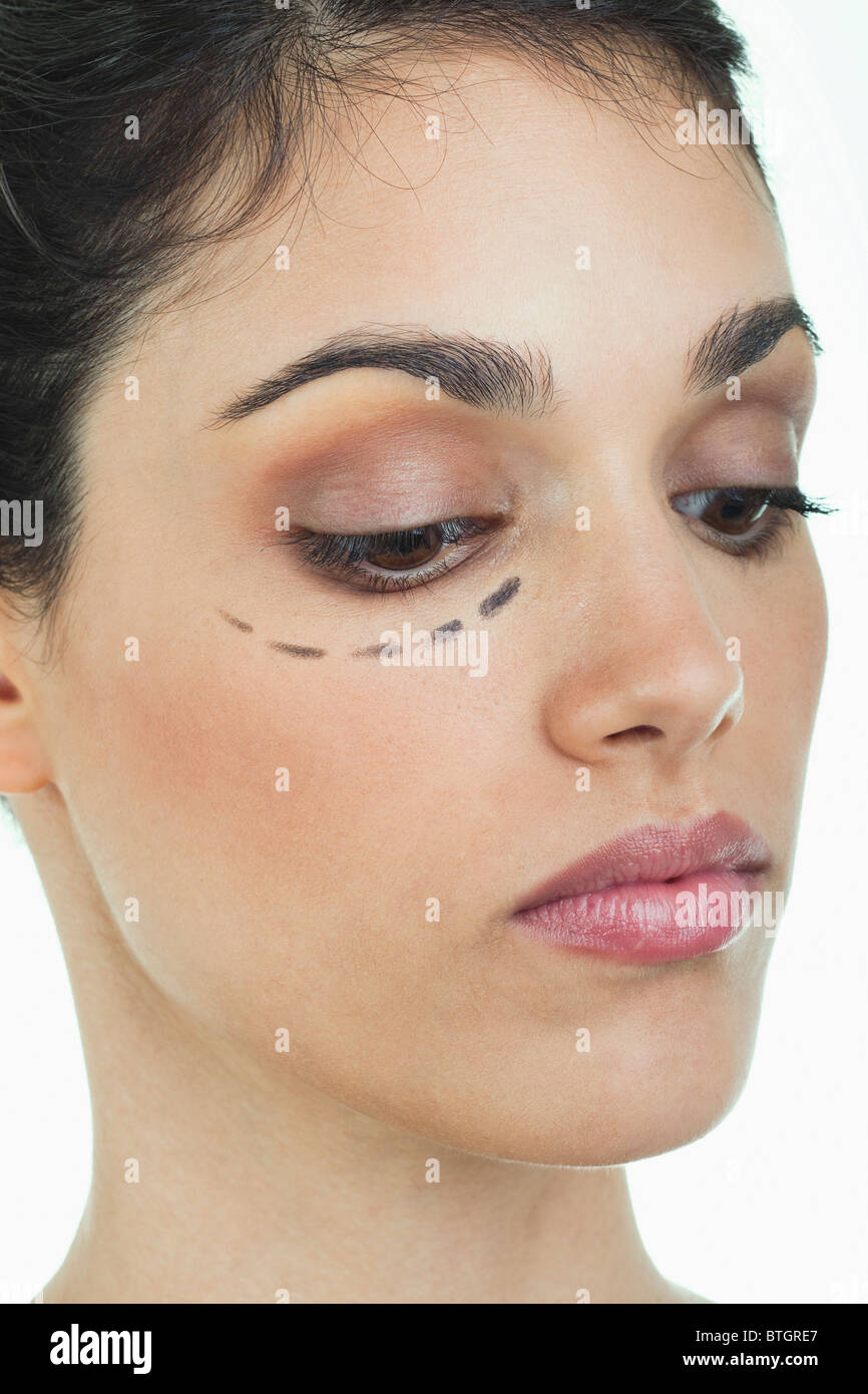 Closeup of patient's face with distance marker Stock Photo - Alamy