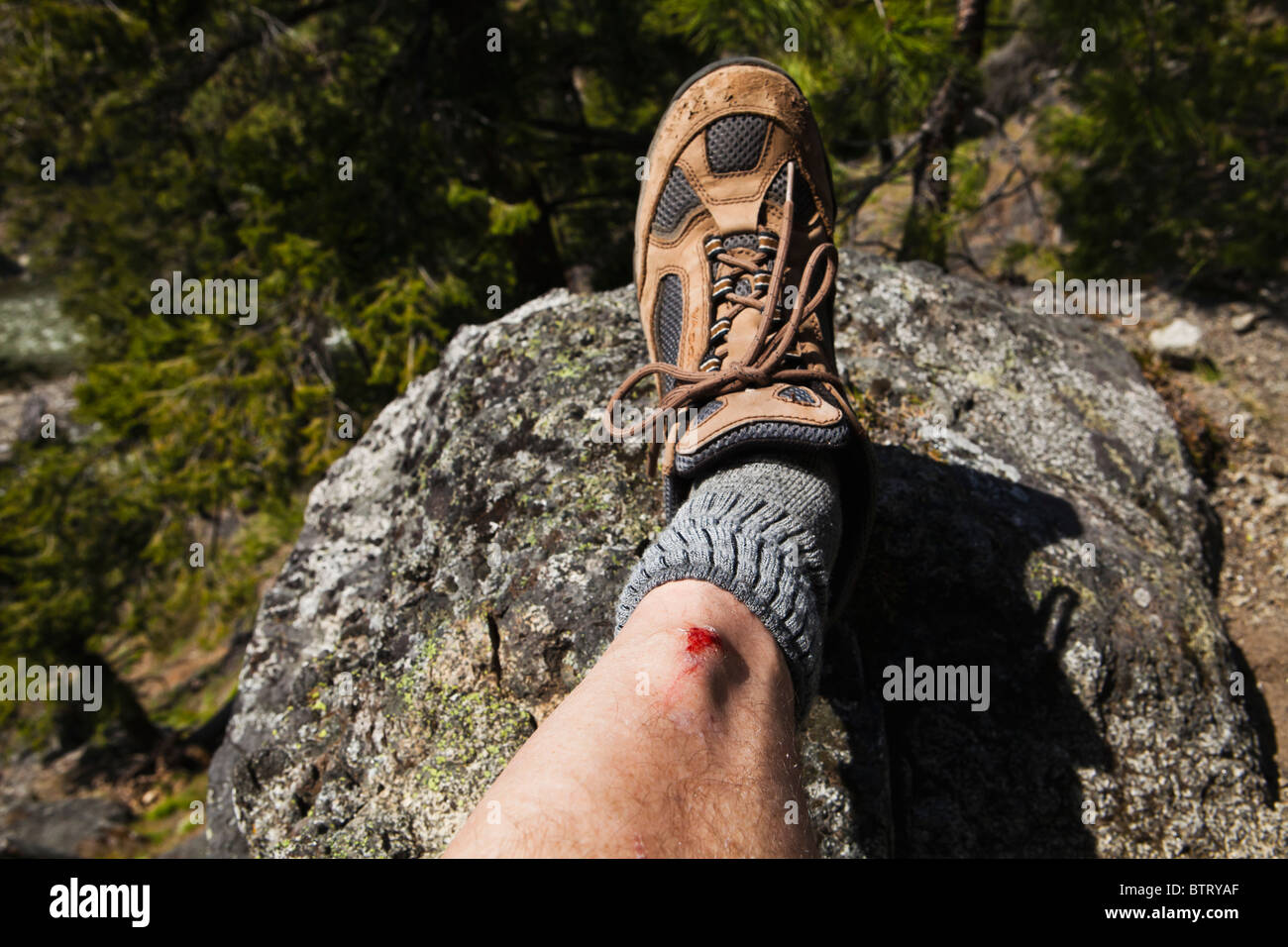 A mans leg with a bleeding contusion on his shin Stock Photo - Alamy