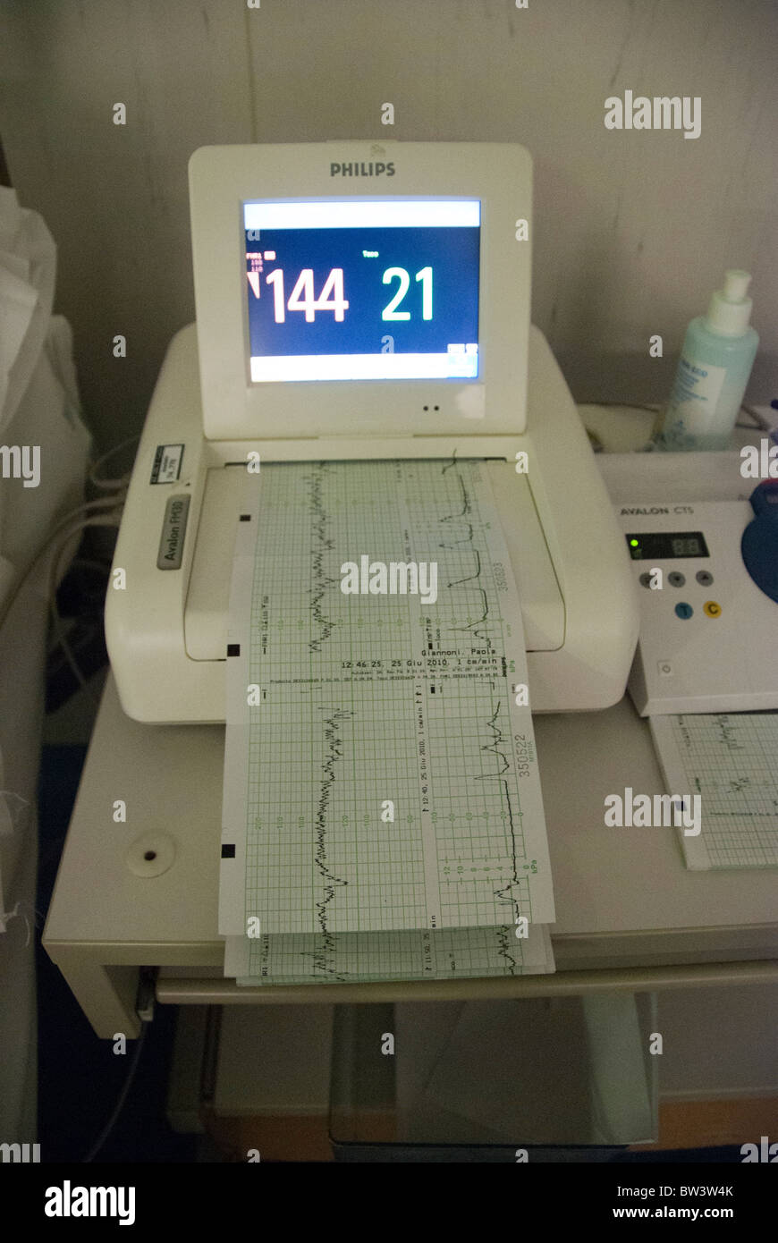 Delivery Room Equipment in a Italian Hospital Stock Photo - Alamy