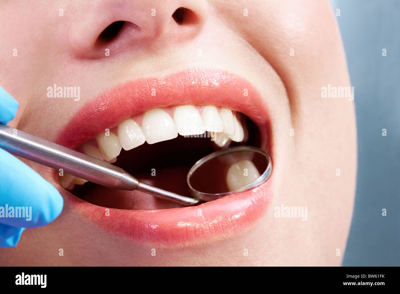 Close-up of open mouth during oral checkup at the dentist’s Stock Photo ...