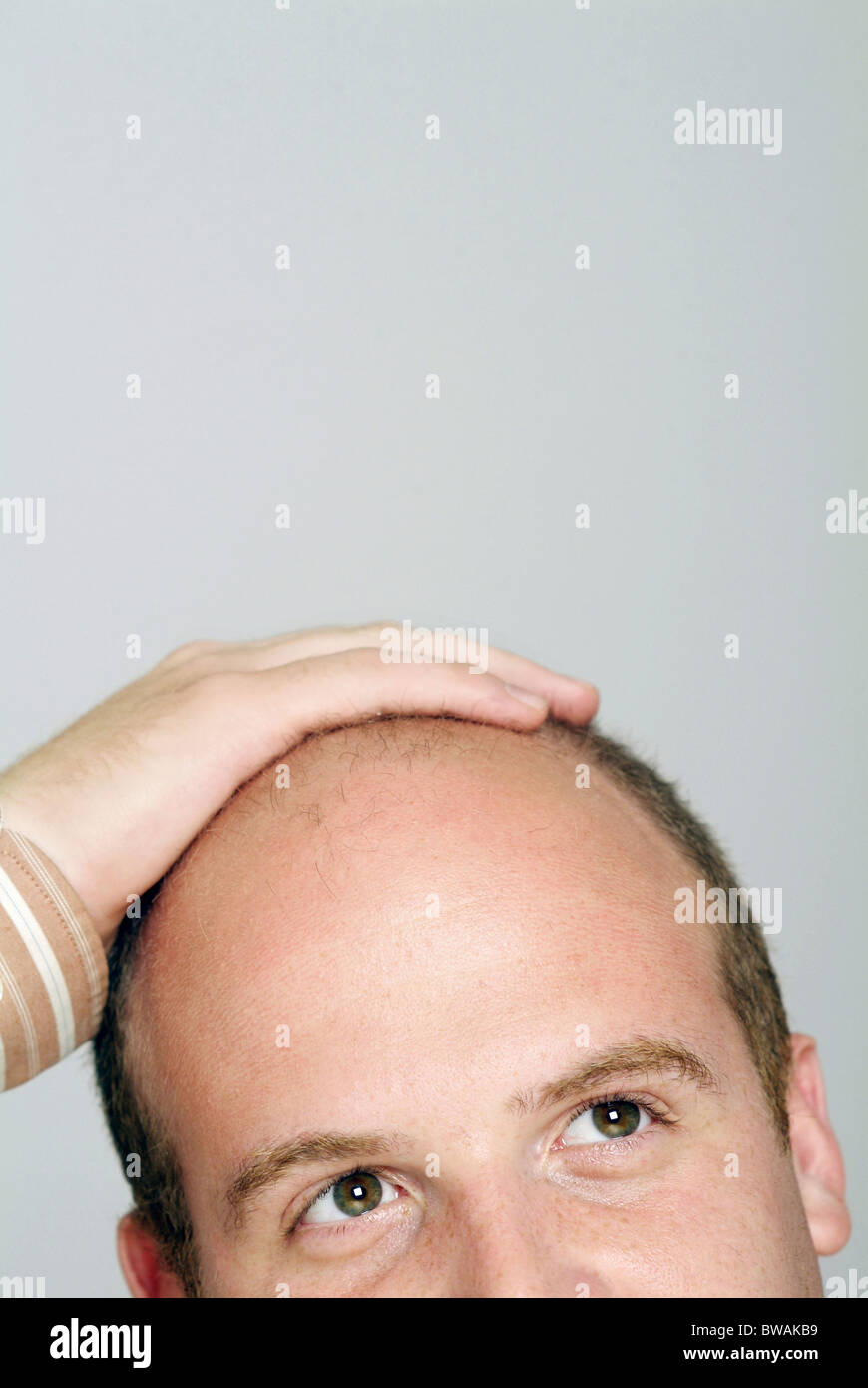 Bald Head And Hand Stock Photos & Bald Head And Hand Stock Images - Alamy