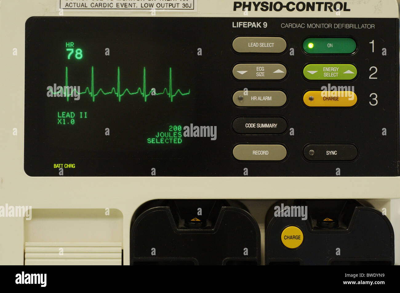 Heart defribillator monitor equipment in a hospital emergency Stock ...