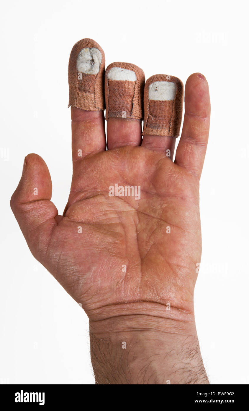 male close up of left hand on white background missing two fingers ...