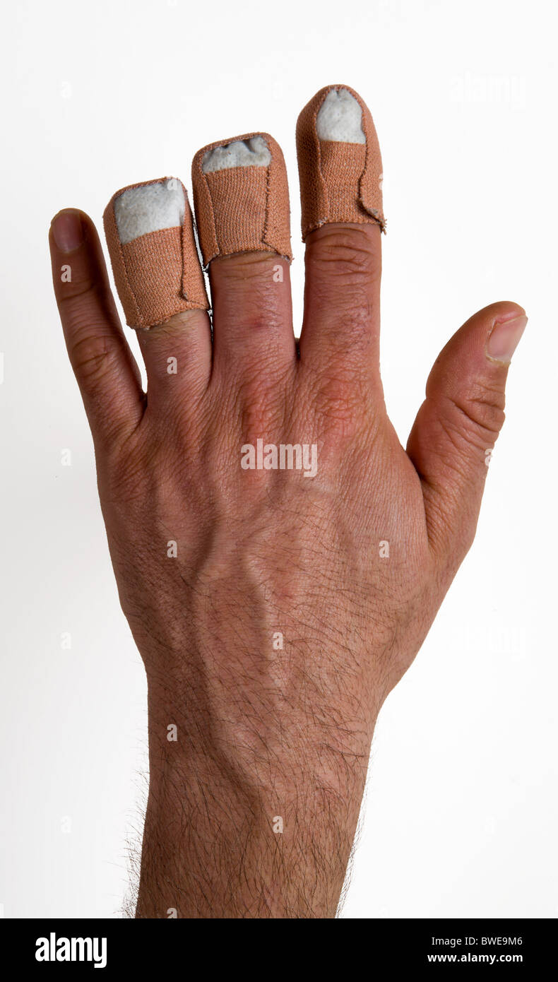 male close up of left hand on white background missing two fingers ...