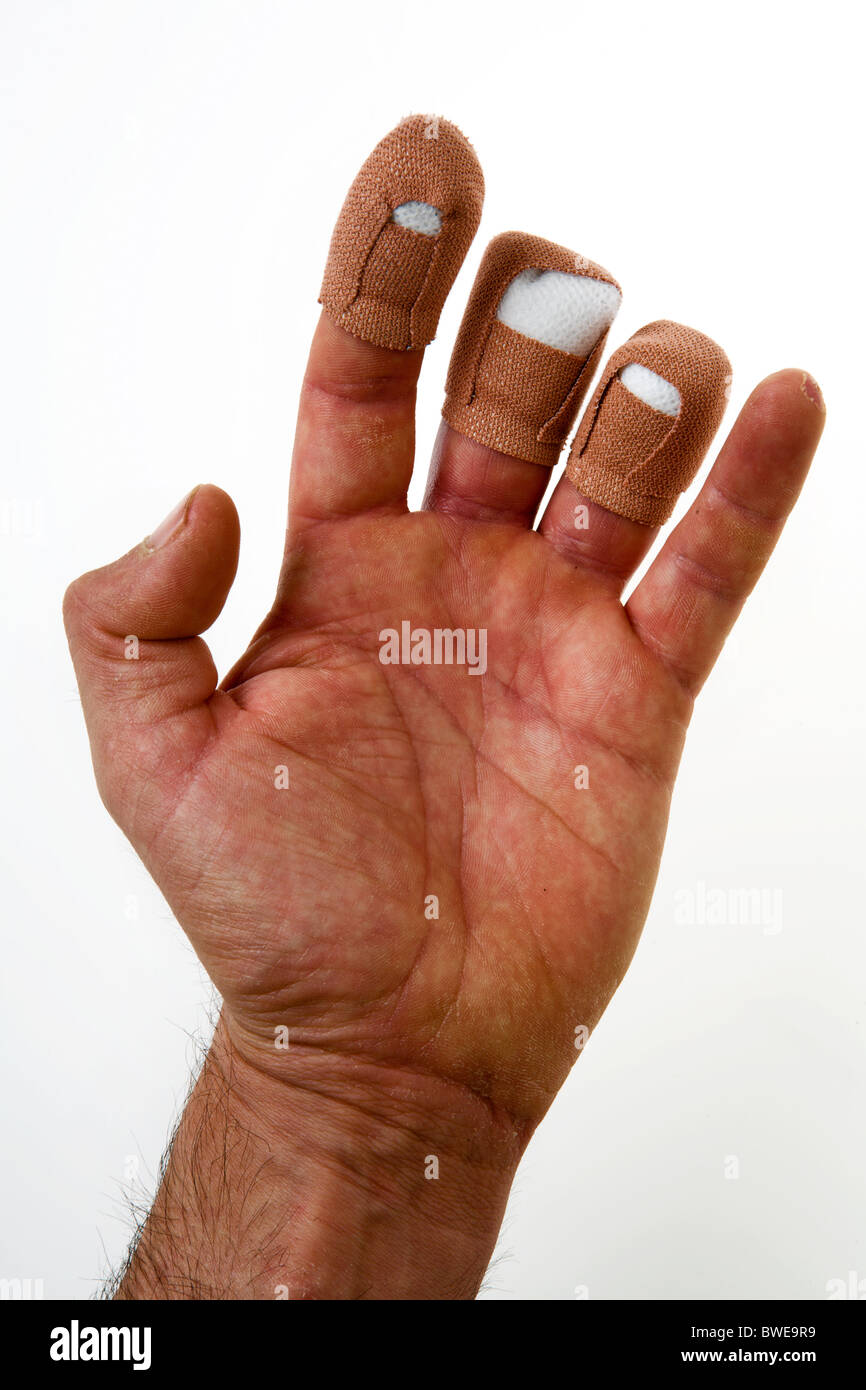 male close up of left hand on white background missing two fingers ...