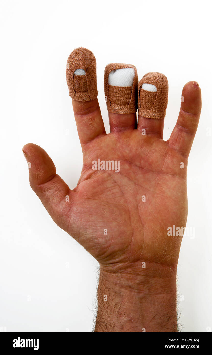 male close up of left hand on white background missing two fingers ...