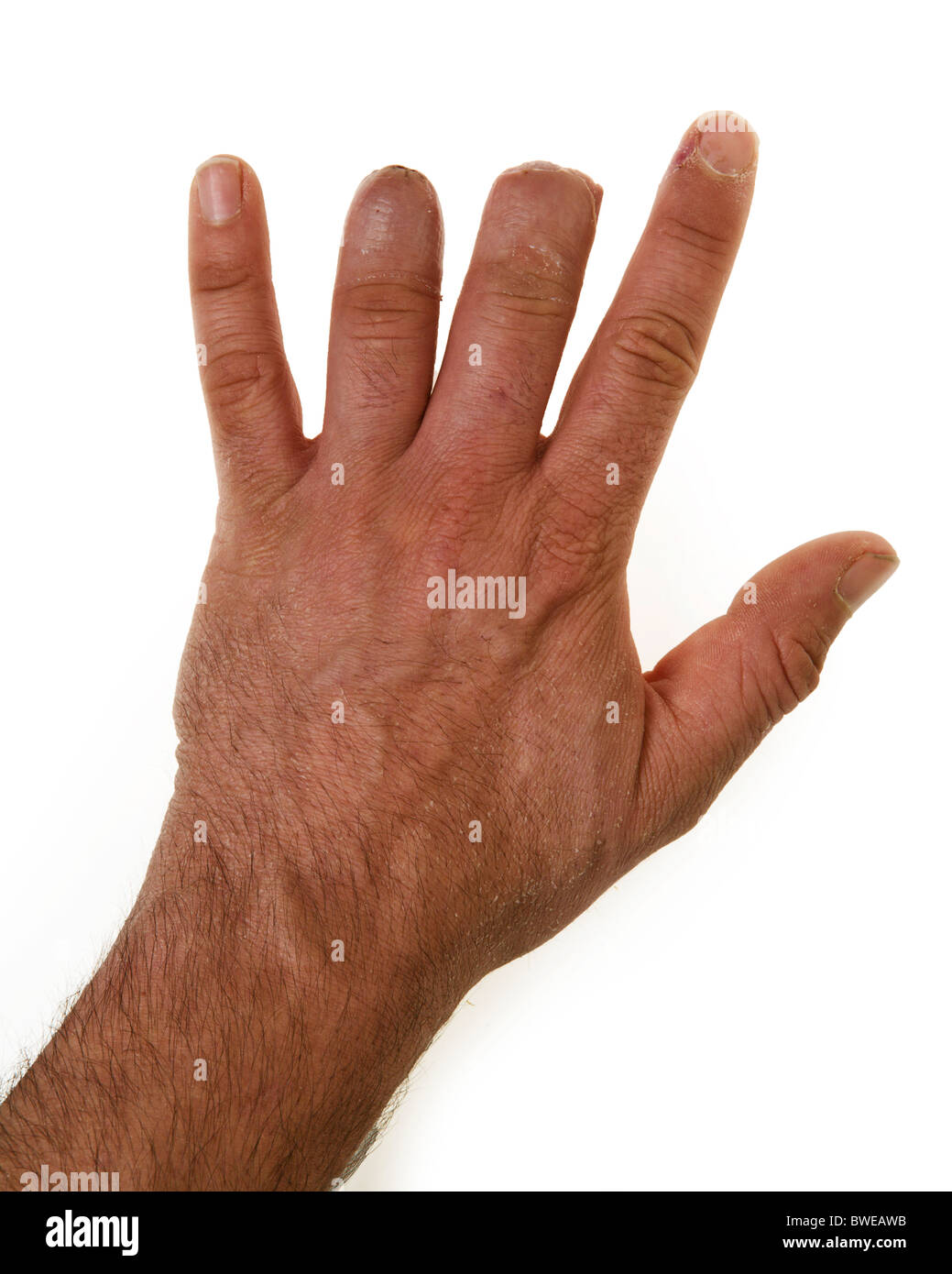 Missing fingers hi-res stock photography and images - Alamy