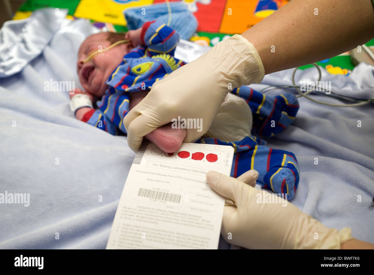 Phenylketonuria disease High Resolution Stock Photography and Images ...