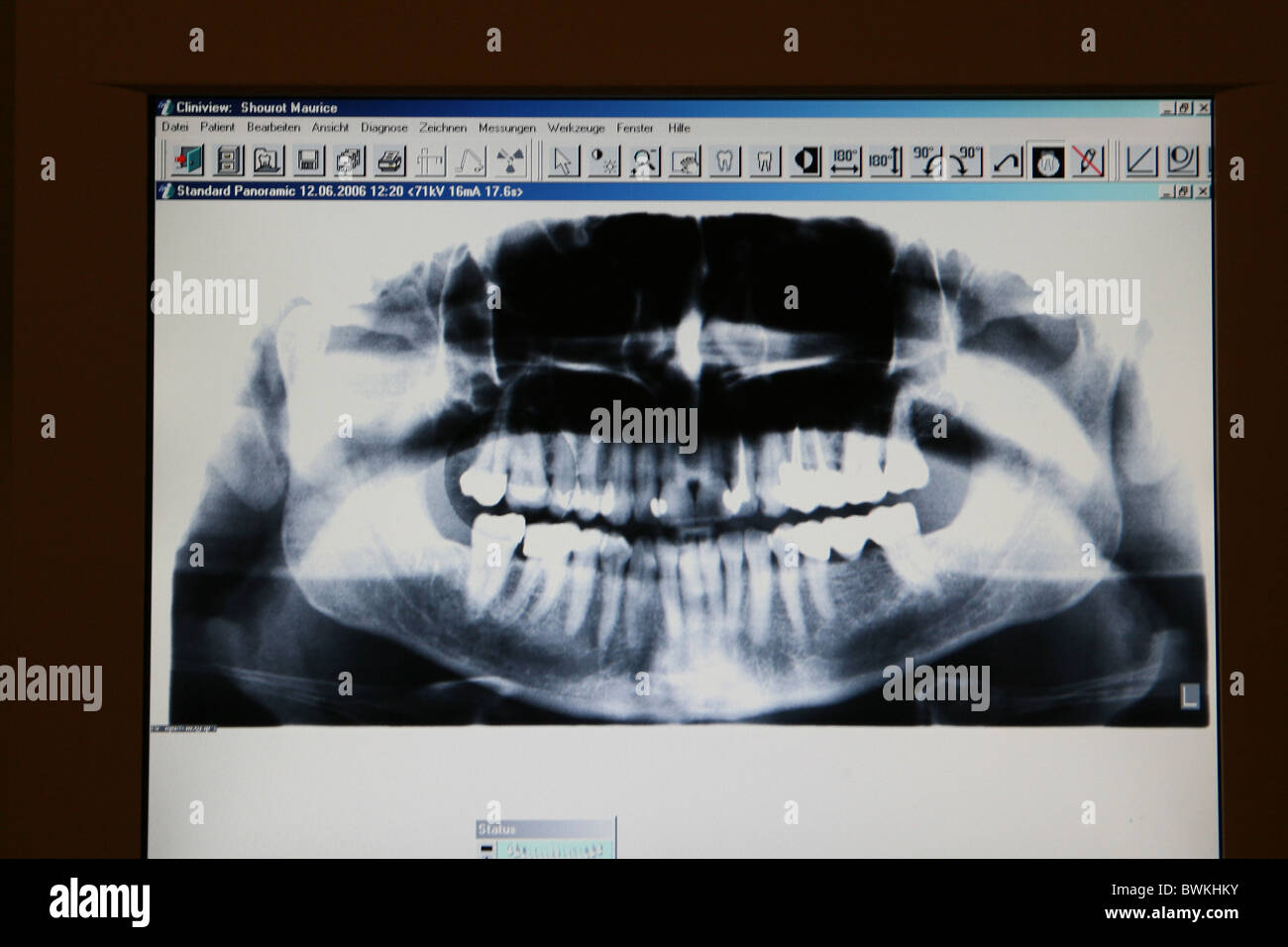 medicine dental medicine dentist dental surgeon X-ray picture X-ray ...